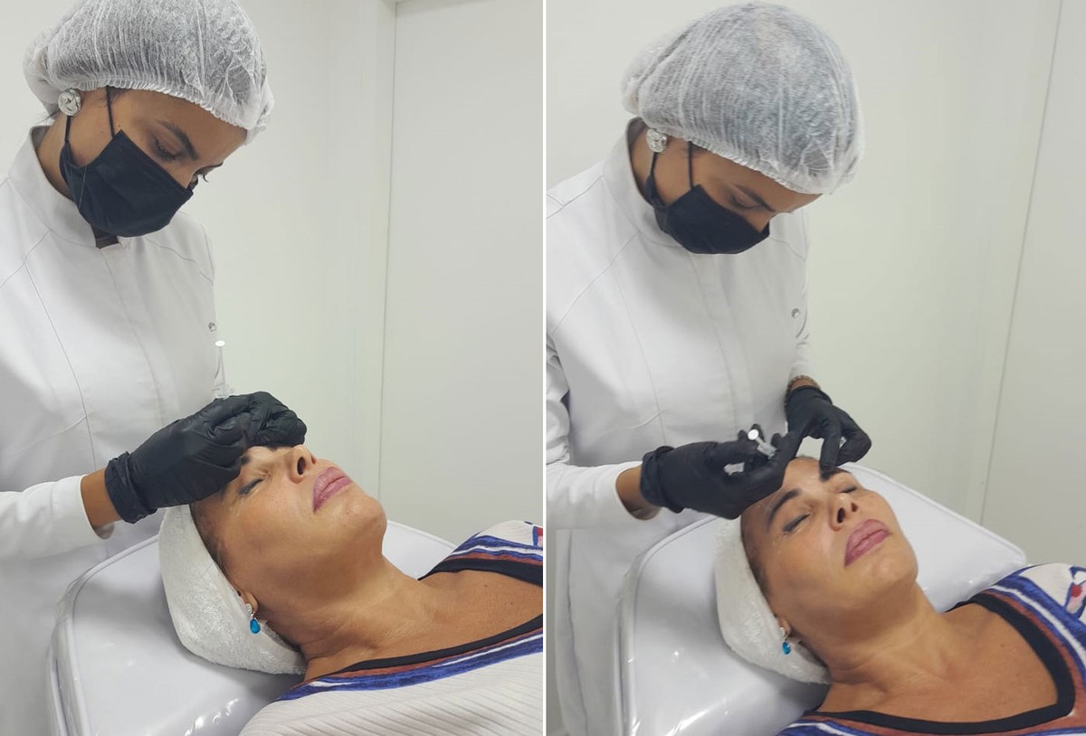 Ângela Bismarchi faz harmonização facial para rejuvenescer naturalmente