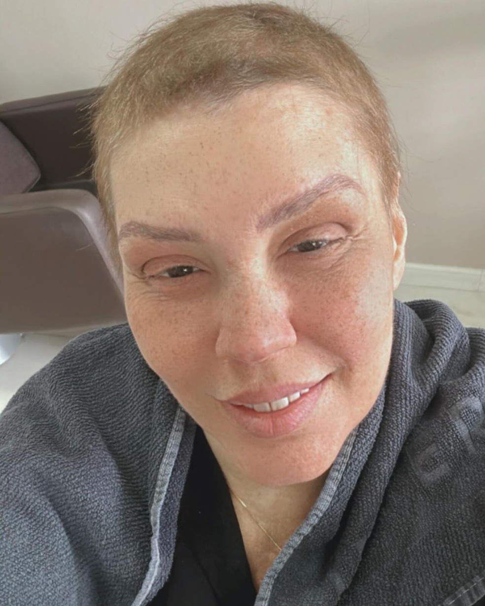 Com câncer em remissão, Simony mostra como está seu cabelo