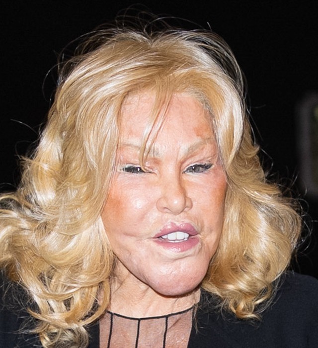 'Recordista em plásticas', Jocelyn Wildenstein faz aparição pública com ...