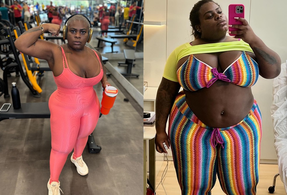 Cirurgião detalha procedimento de Jojo Todynho após perder 50 kg