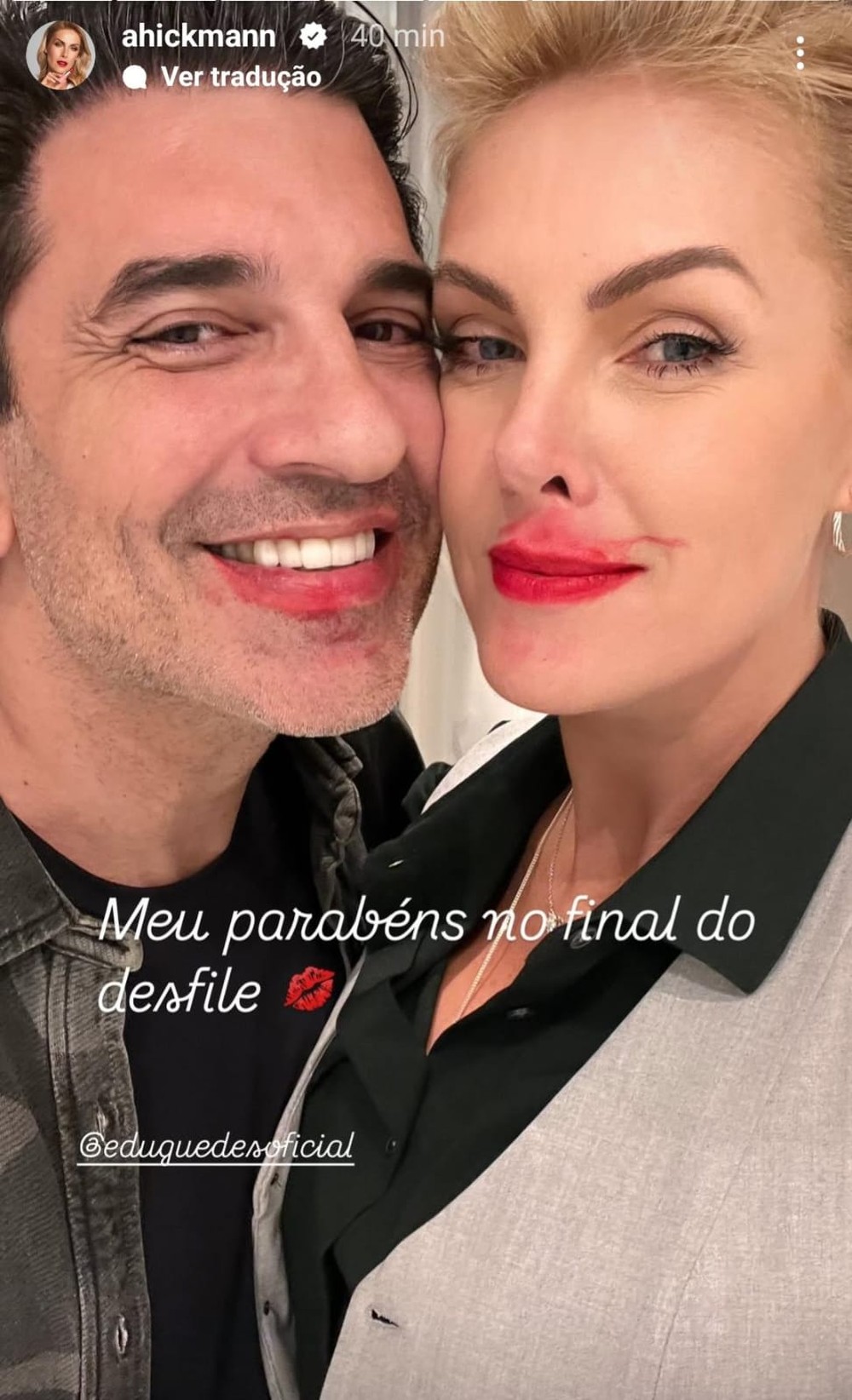 Ana Hickmann e Edu Guedes mostram bocas borradas de batom após beijões