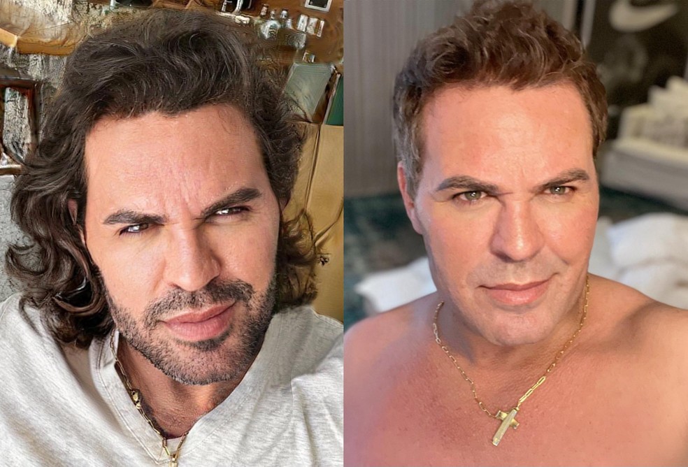 Eduardo Costa rejeita críticas à careca: 'Inteligência vale mais que beleza'