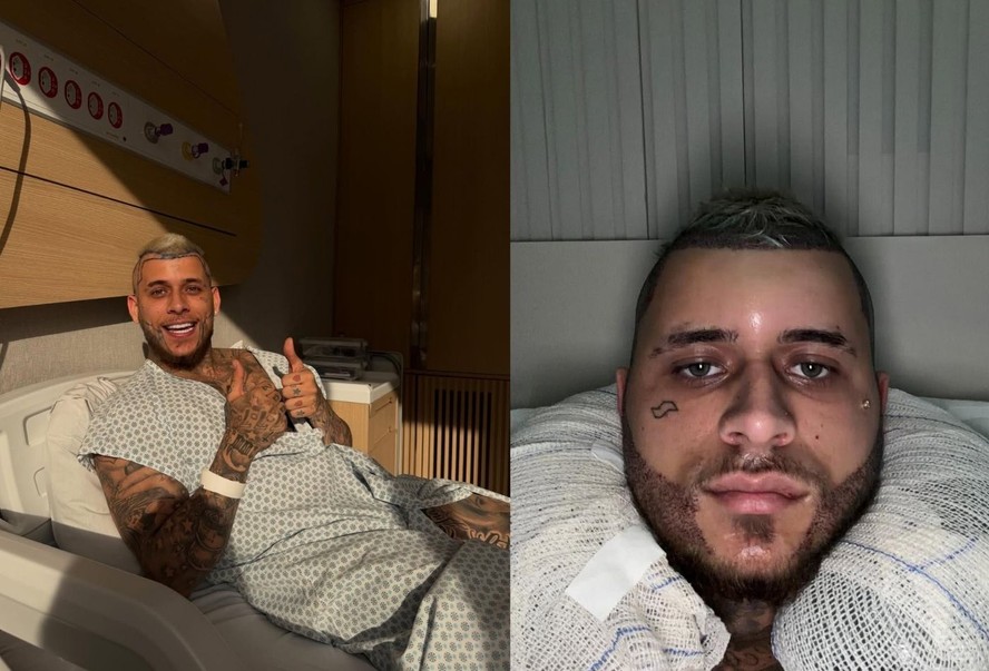 É normal? Especialista explica inchaço no rosto de MC Pedrinho após ...