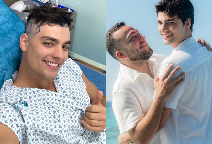 Lucas Bley, marido de Lucas Rangel, faz transplante capilar: 'Nunca ...