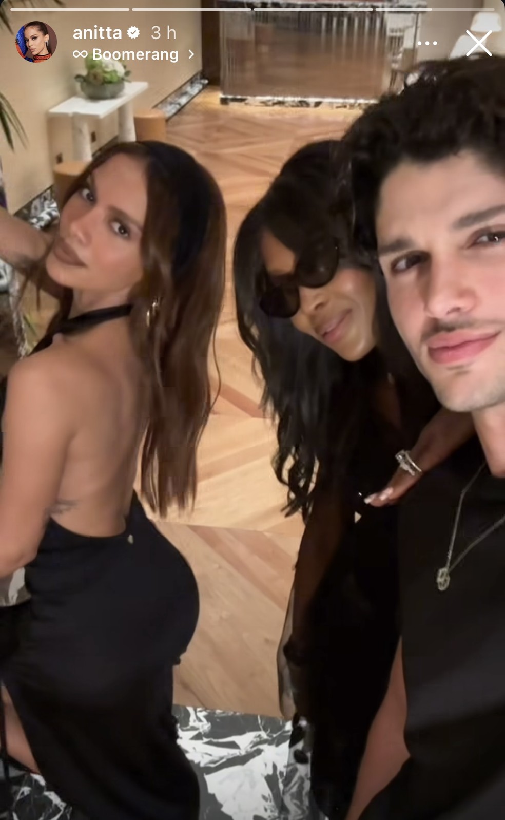 Após Anitta reaparecer com 'novo rosto' na internet, especialistas ...