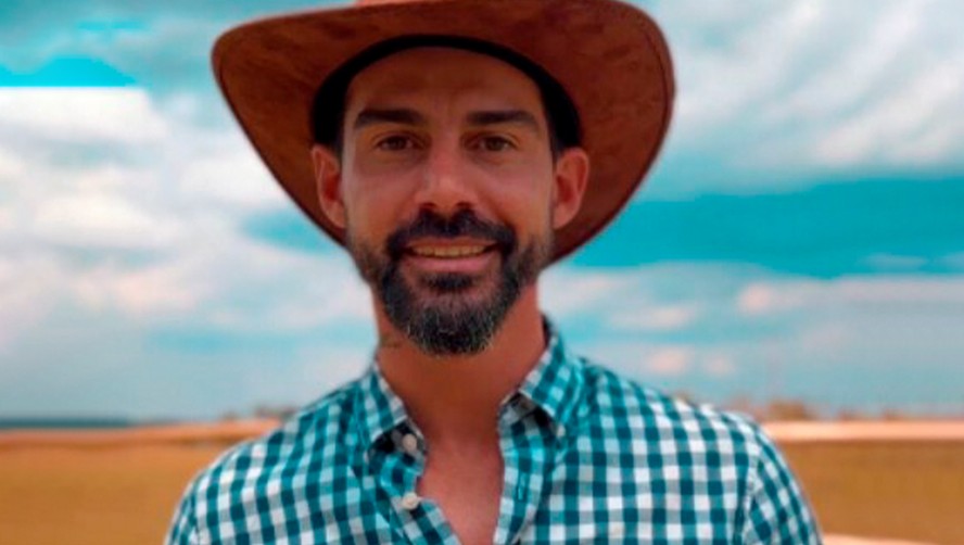 Jogador Radamés passa por harmonização facial; veja antes e depois