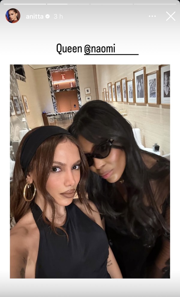 Após Anitta reaparecer com 'novo rosto' na internet, especialistas listam possíveis ...