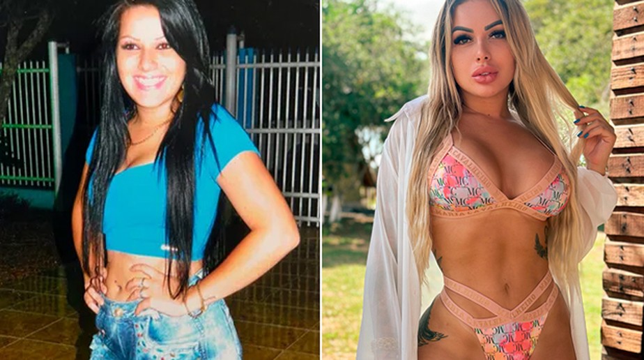 Influencer que gastou mais de R$ 500 mil em plásticas lembra dietas: 'Fazia de tudo'
