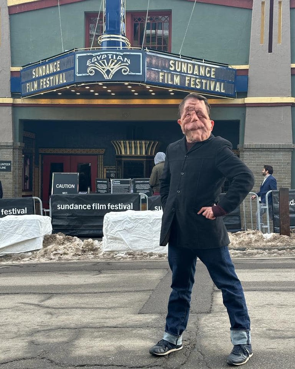 Adam Pearson — Foto: Reprodução/Instagram