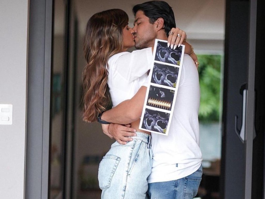 Thássia Naves anuncia primeira gravidez: 'Só nós sabemos o quanto desejamos'