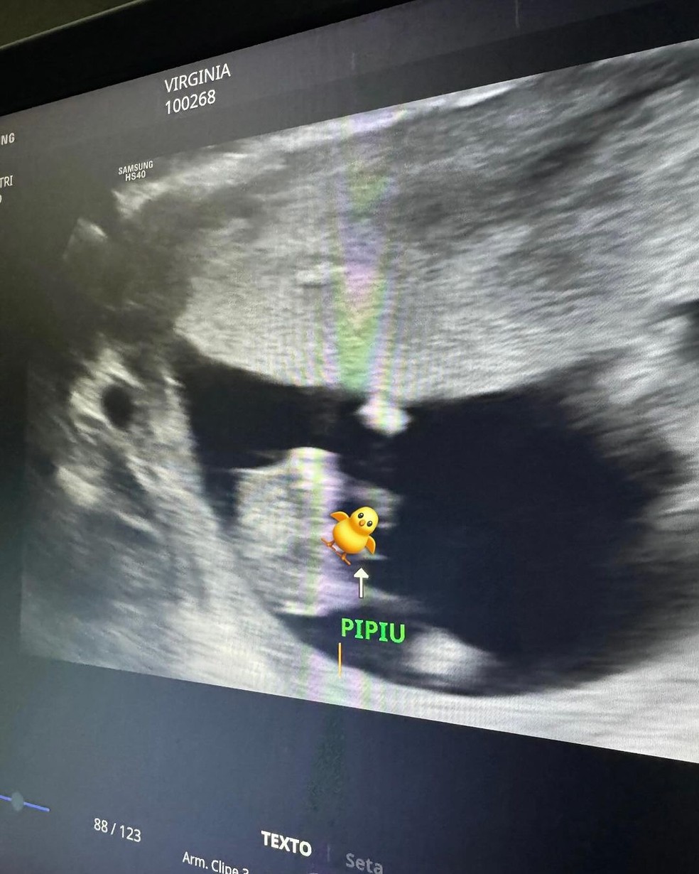 Grávida, Virginia diz que pediu para ver o 'pipiu' do filho em ...