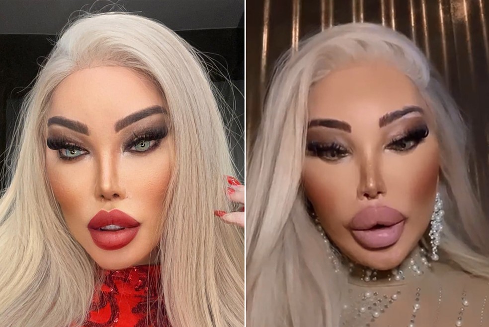 Jessica Alves faz novo preenchimento nos lábios e resultado impressiona ...