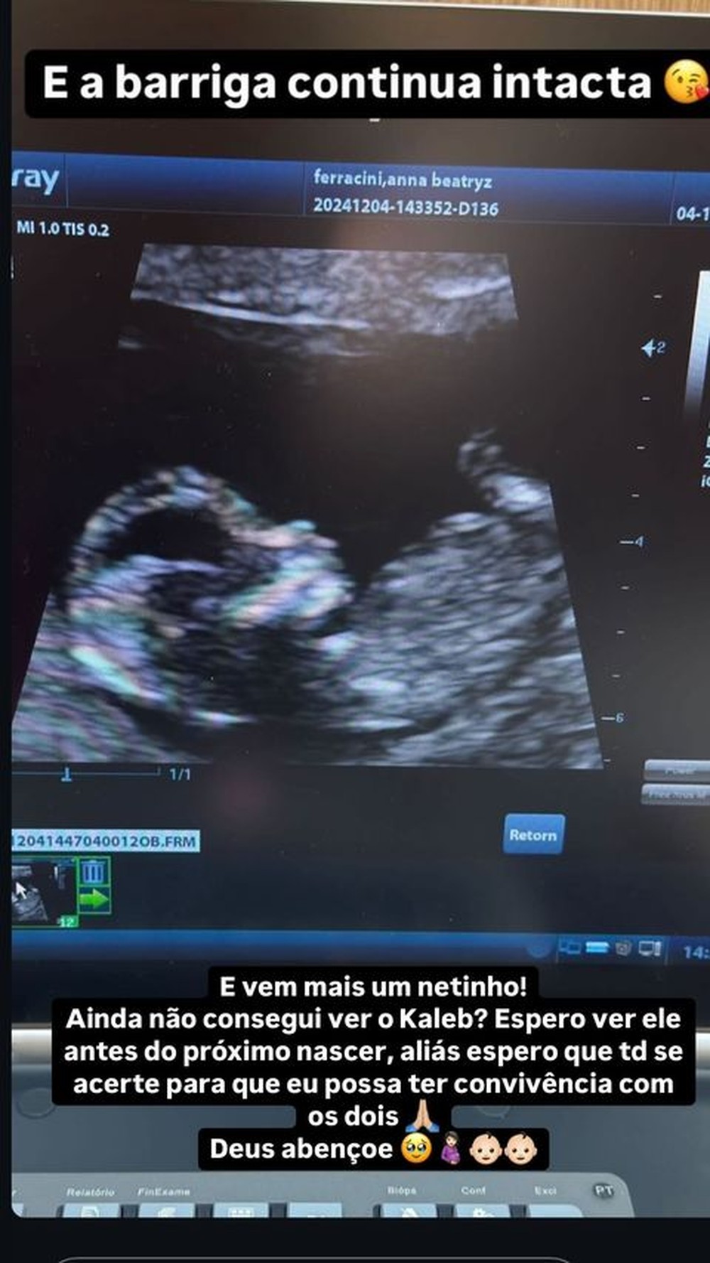 Jenny Miranda lamenta não ter conhecido neto mais velho, filho de Bia ...