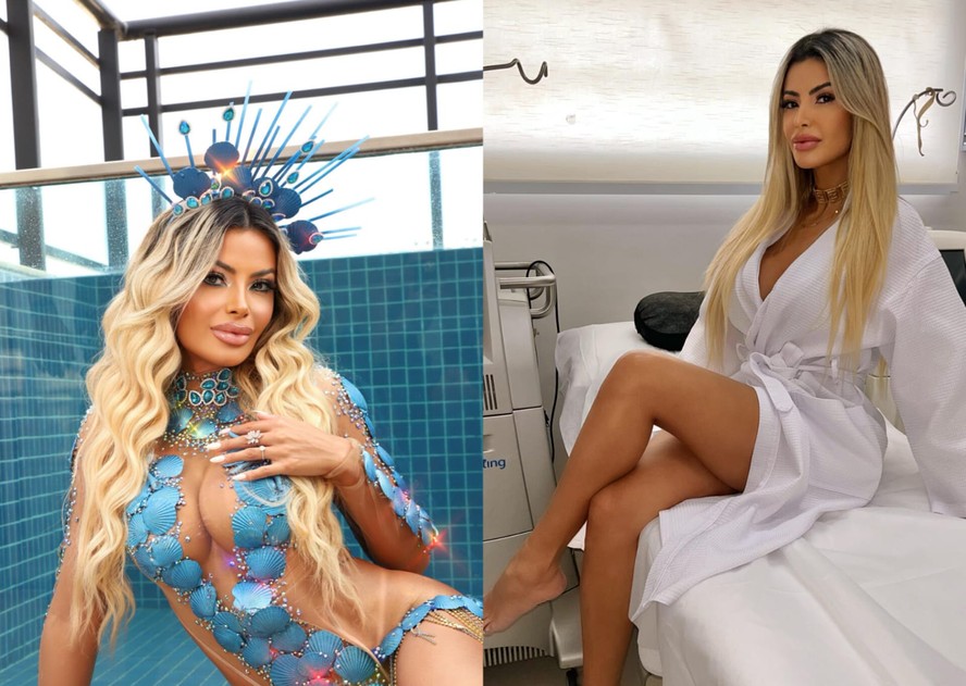 Musa da Acadêmicos do Tatuapé, Janaina Prazeres faz procedimento estético para o Carnaval