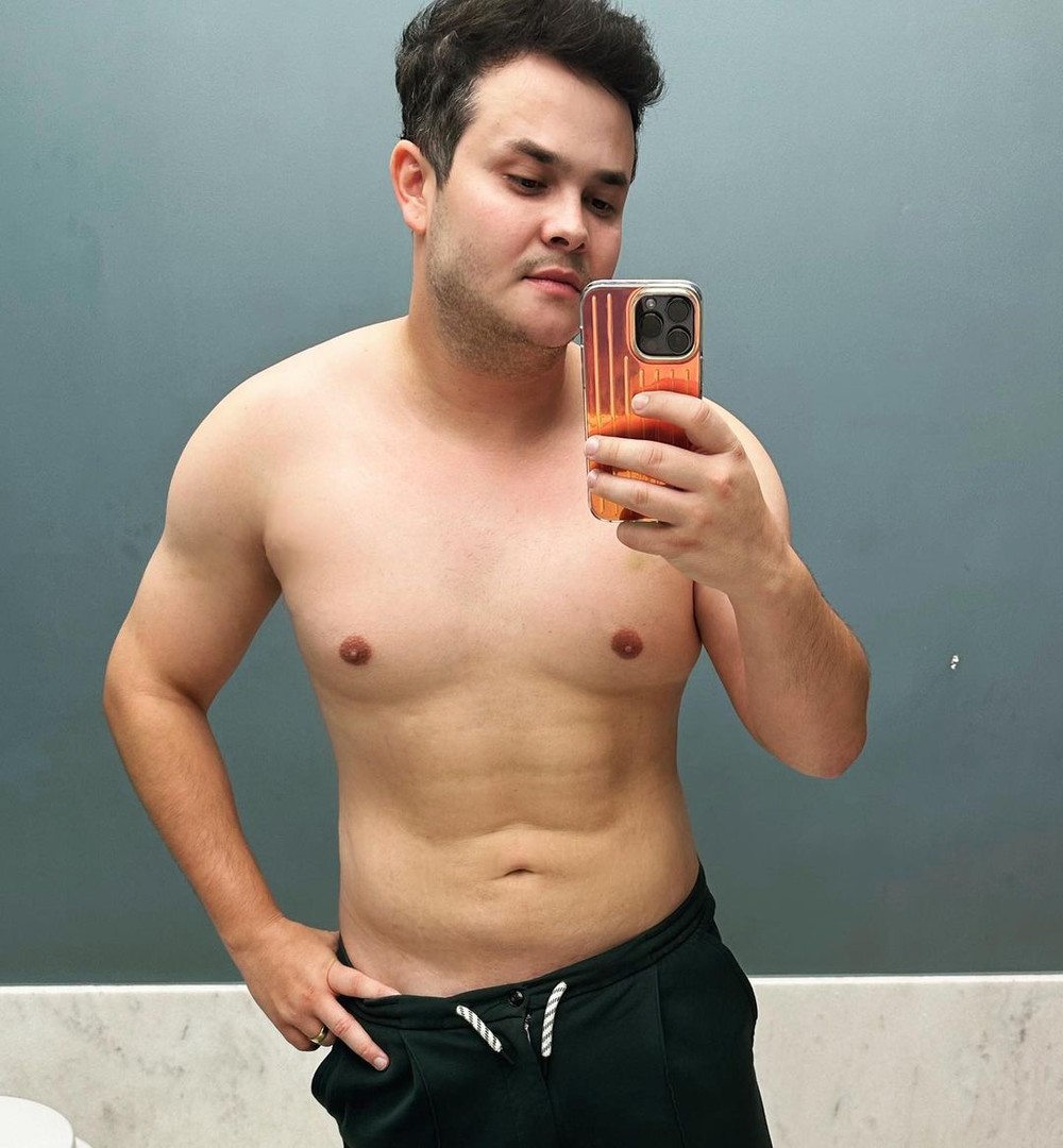 Matheus, de dupla com Kauan, mostra antes e depois de Lipo LAD