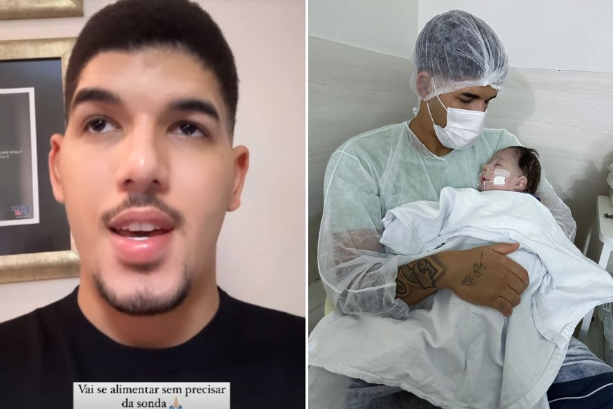 Síndrome de Patau: entenda a condição rara que acomete o filho caçula ...