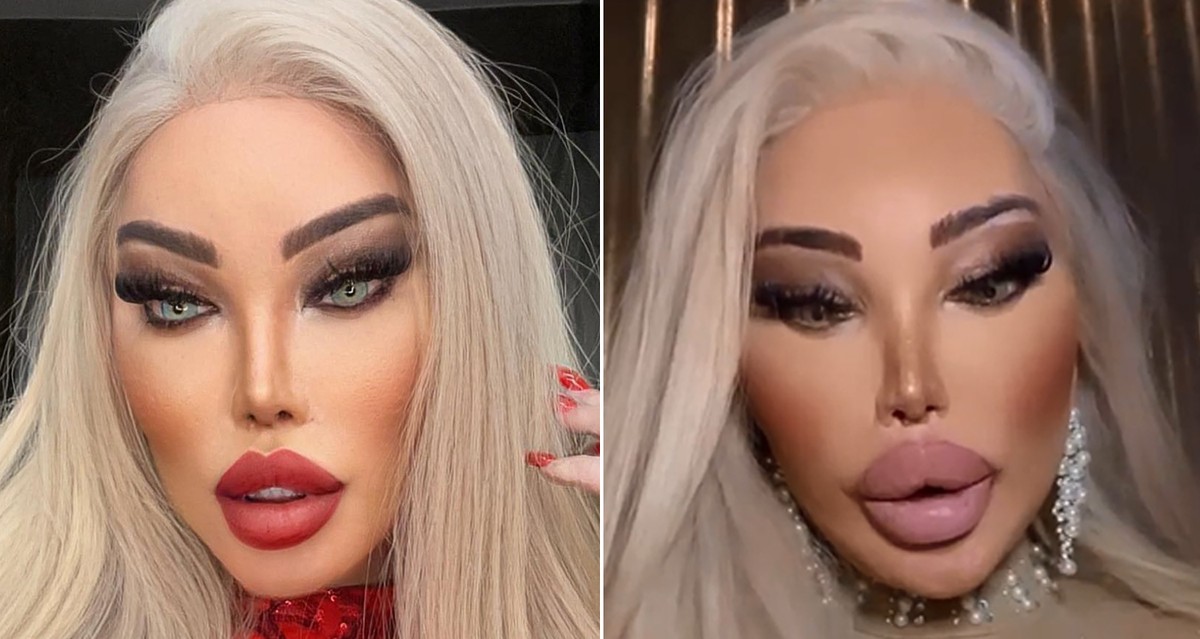 Jessica Alves faz novo preenchimento nos lábios e resultado impressiona ...