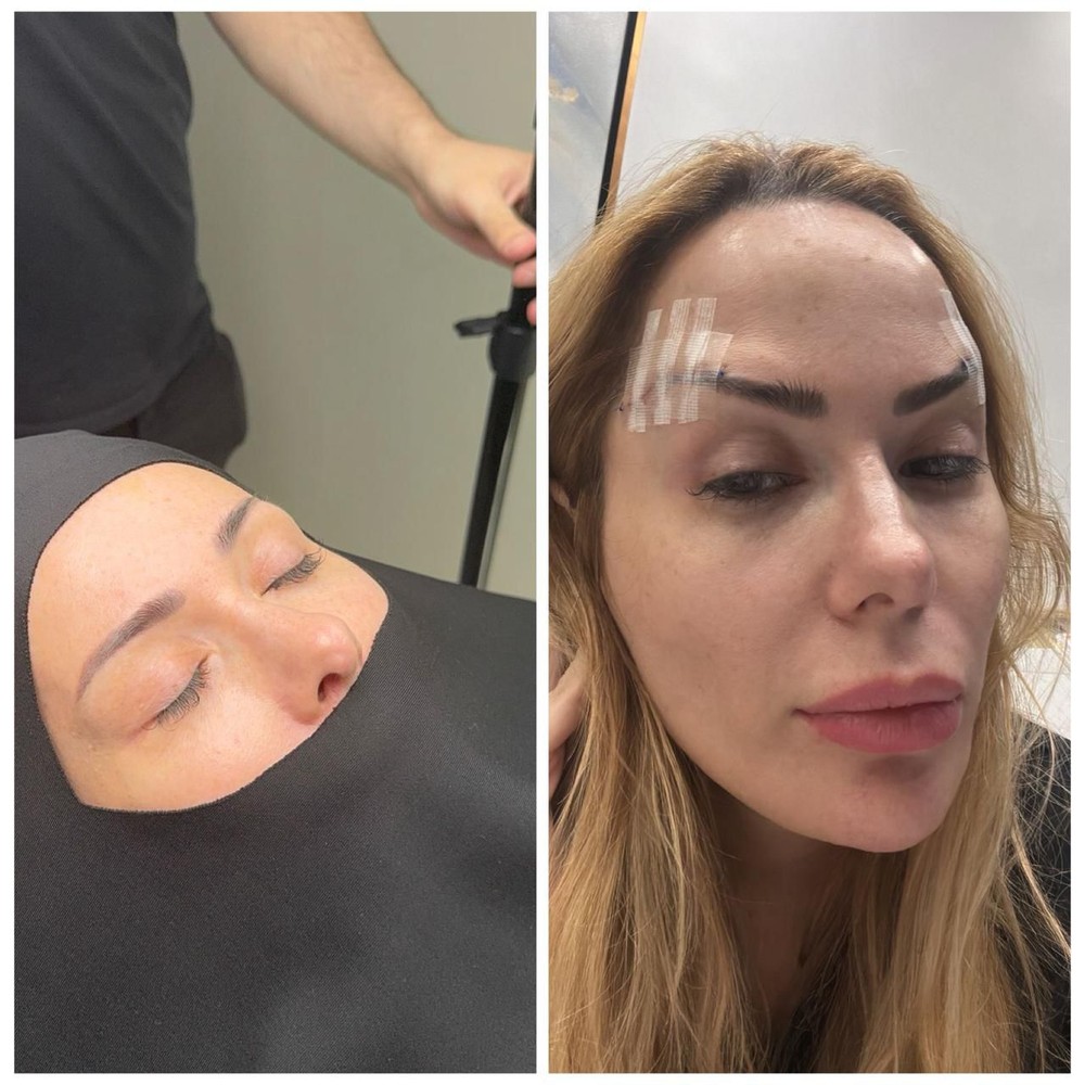 Ju Isen se recupera de fox eyes e fala sobre morte de influenciador que ...