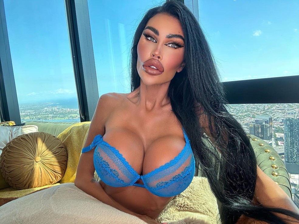 Tara Jayne, a 'Barbie humana' australiana, depois de retirar boa parte do seu preenchimento ...