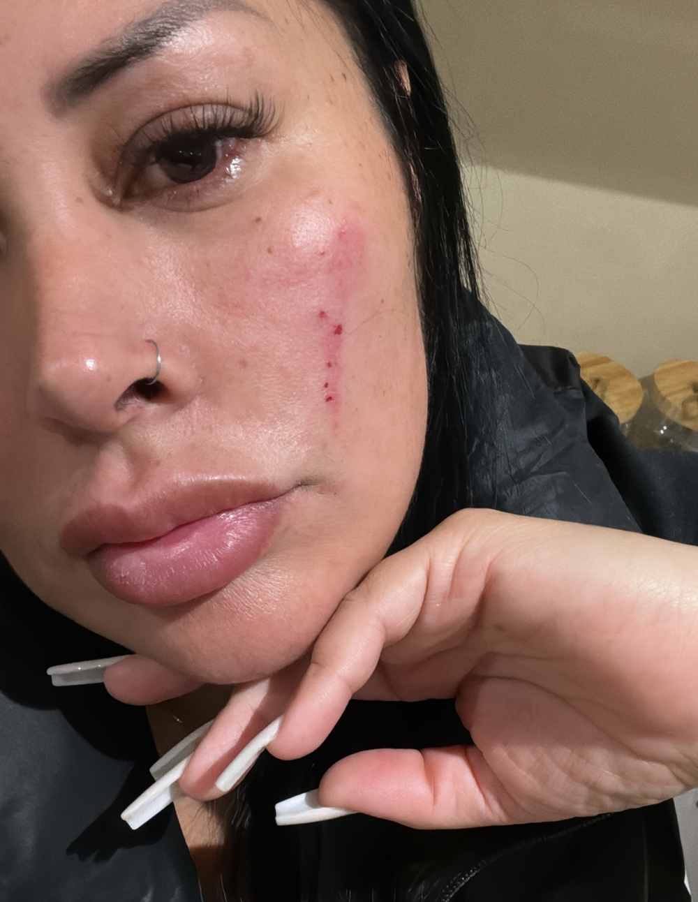 Esposa de Lincoln, ex-Bragantino, faz exame de corpo de delito após ...