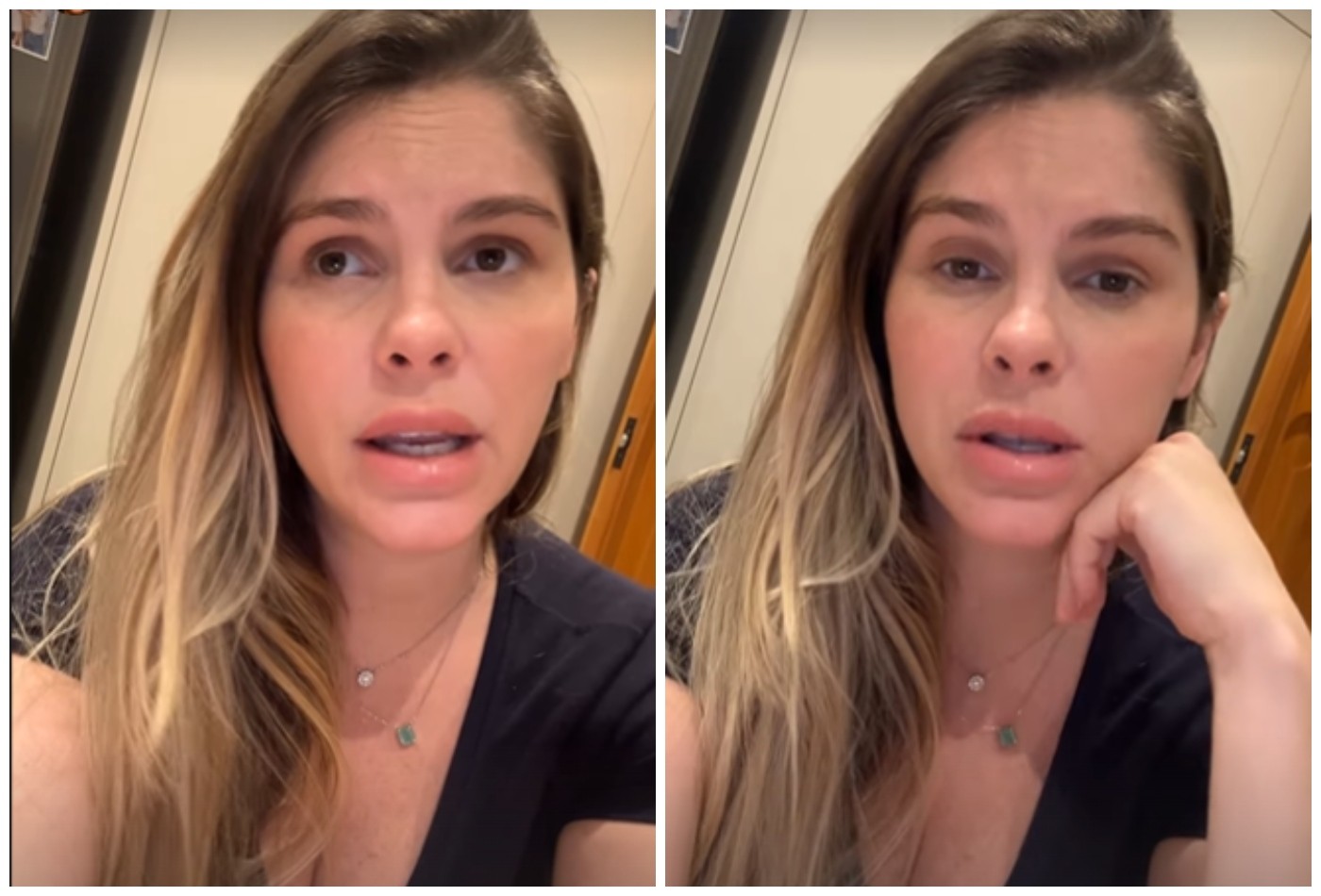 Após dar à luz gêmeos, Bárbara Evans diz que fará cirurgia plástica ...