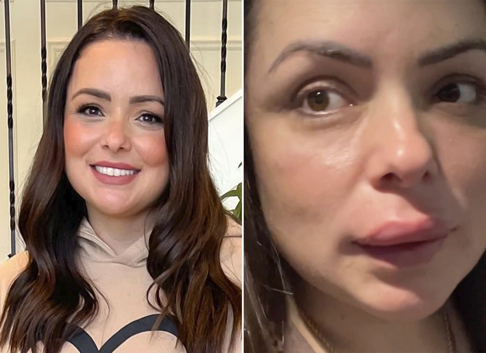 Influencer mostra reação dos filhos ao aparecer com boca inchada após ...