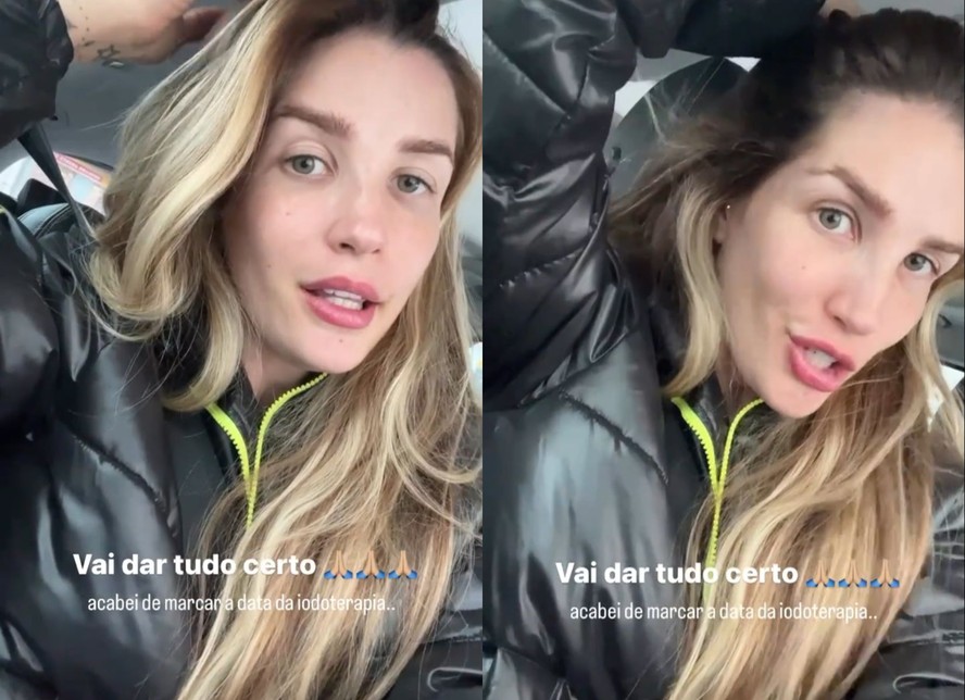 Aline Gotschalg marca data de iodoterapia: 'Confiante e com muita fé'