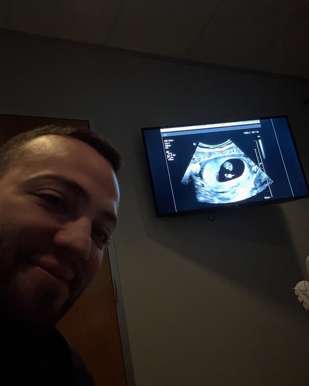 Lucas Rangel e Lucas Bley anunciam: 'Estamos esperando um bebê'