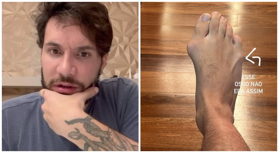 Eliezer mostra pé e brinca com formato: 'Tipo Pokémon'