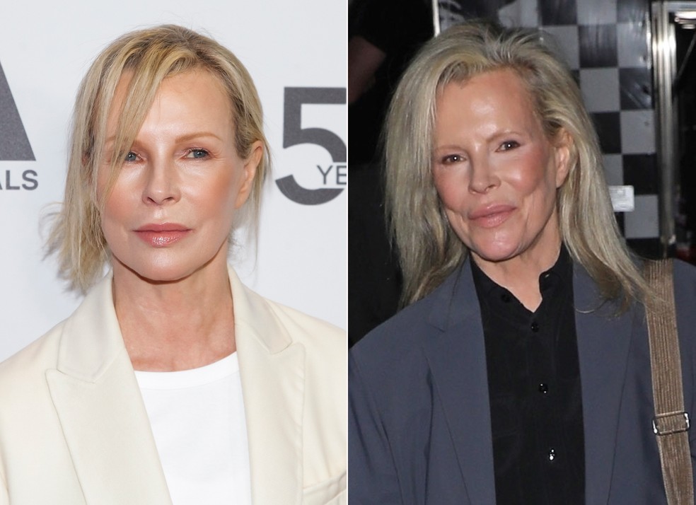 Kim Basinger, ganhadora do Oscar, surge irreconhecível em chá de bebê ...