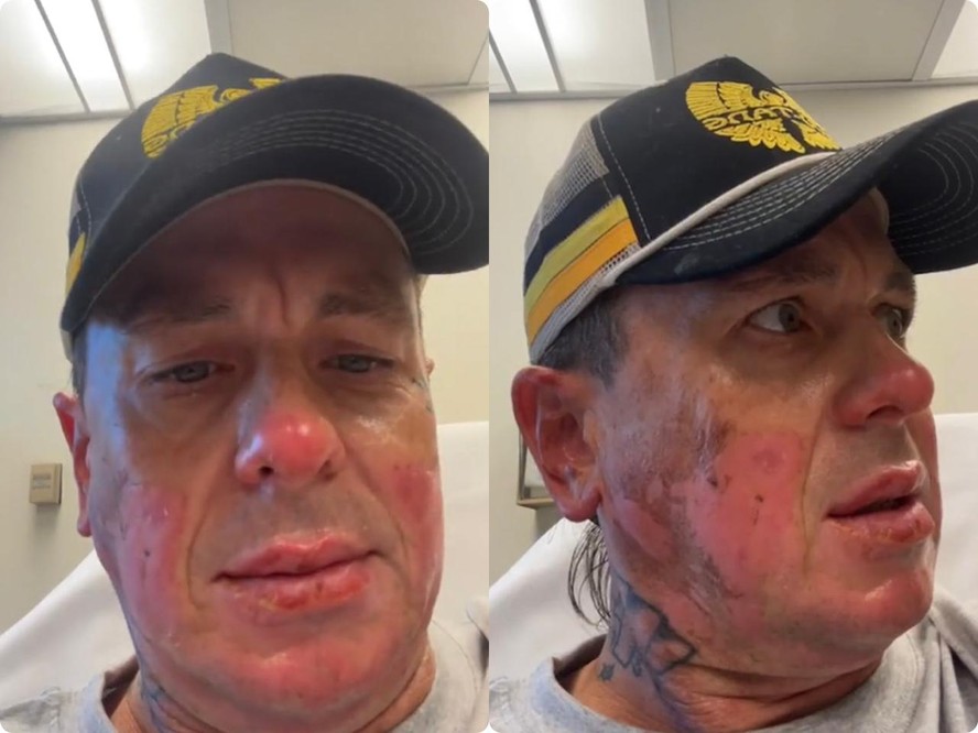 Sid Wilson, do Slipknot, diz se sentir 'estúpido' após acidente que ...