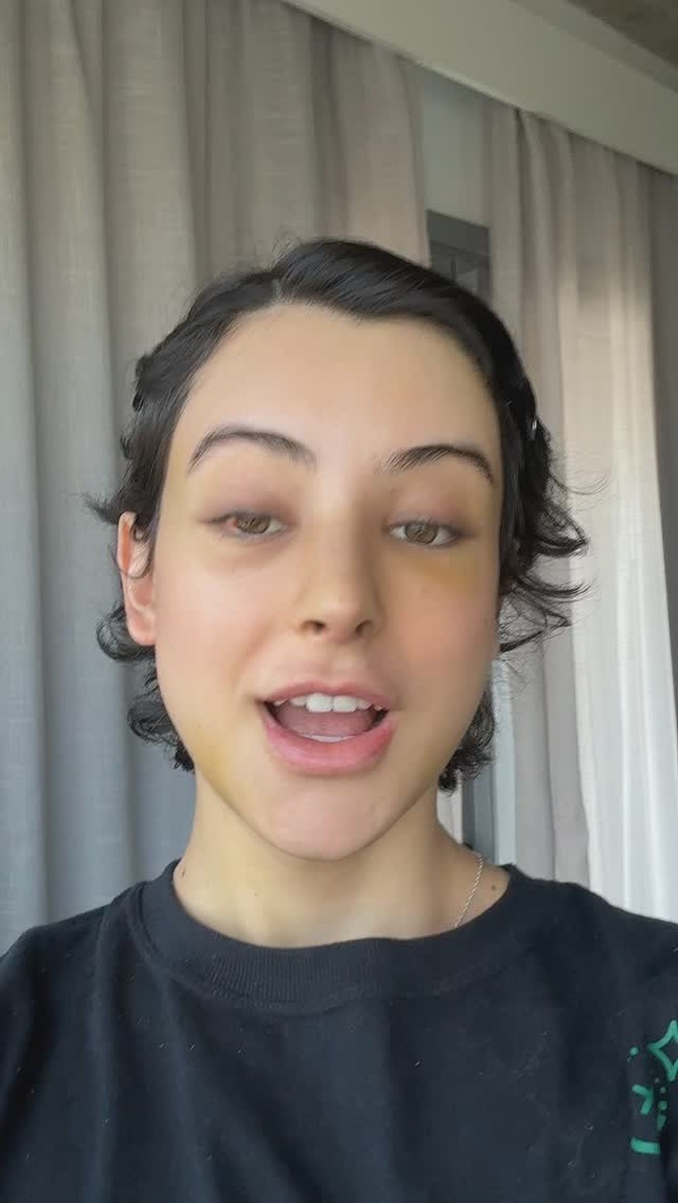 Sem curativos, Zé Longuinho mostra resultado de feminização facial; compare