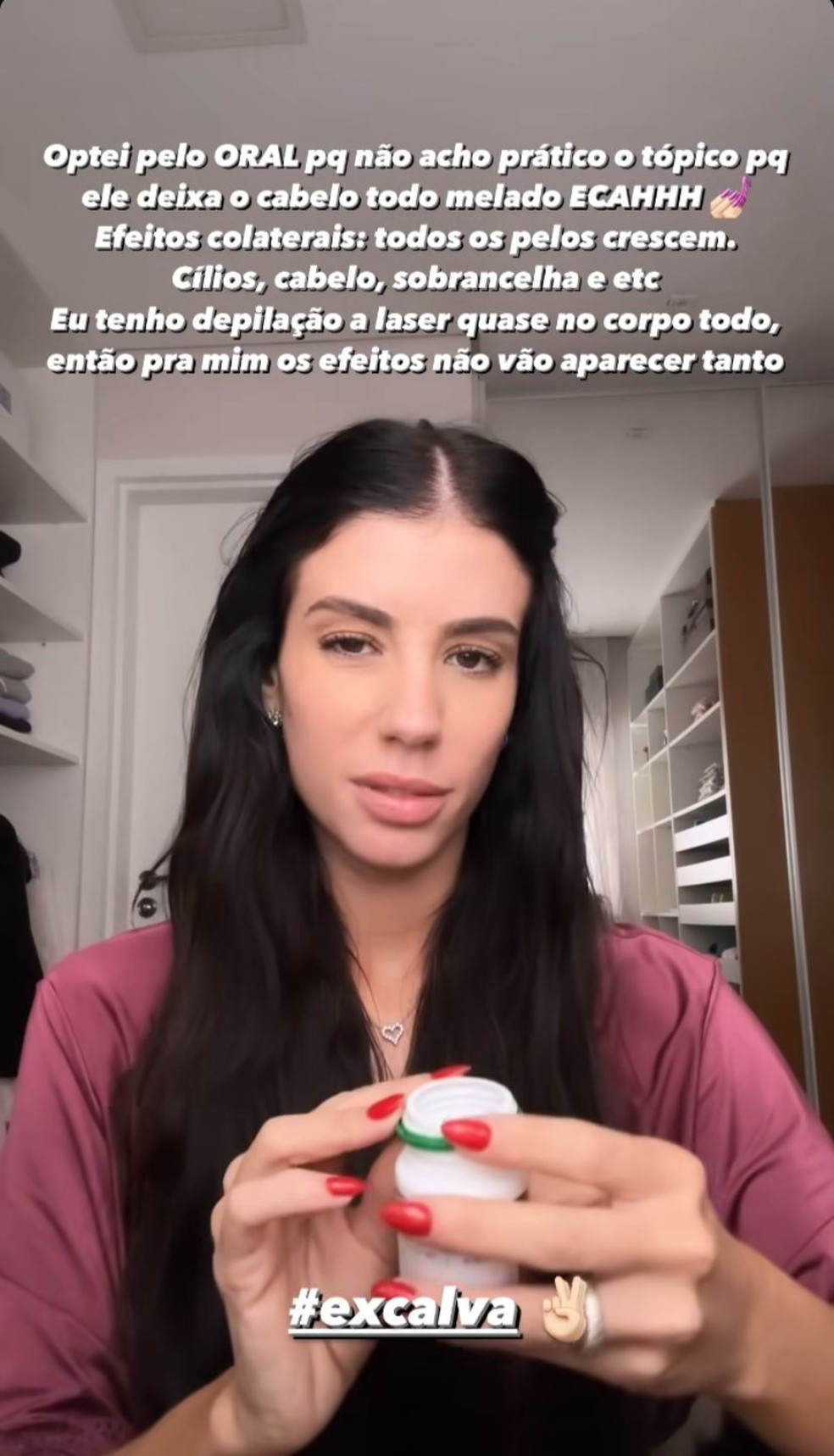 Maria Lina revela diagnóstico de alopecia e detalha efeitos colaterais ...