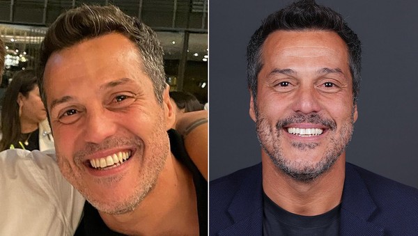 Ex-goleiro da Seleção, Julio Cesar dá recauchutada no sorriso; veja ...
