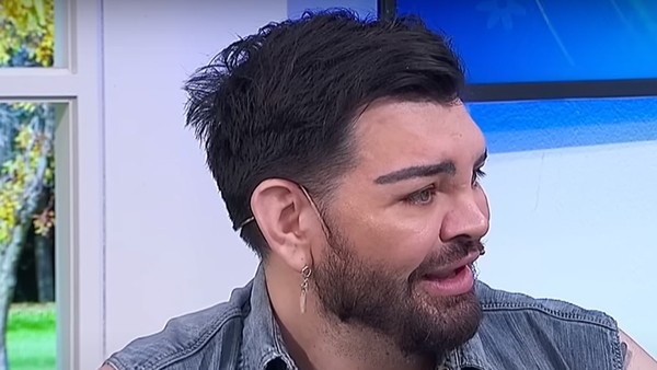 Homem faz mais de 30 cirurgias plásticas para se parecer com Ricky ...