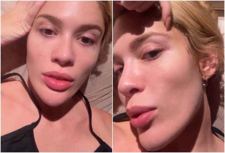 Após término polêmico, Karoline Lima explica olhos inchados: 'Sei que ...