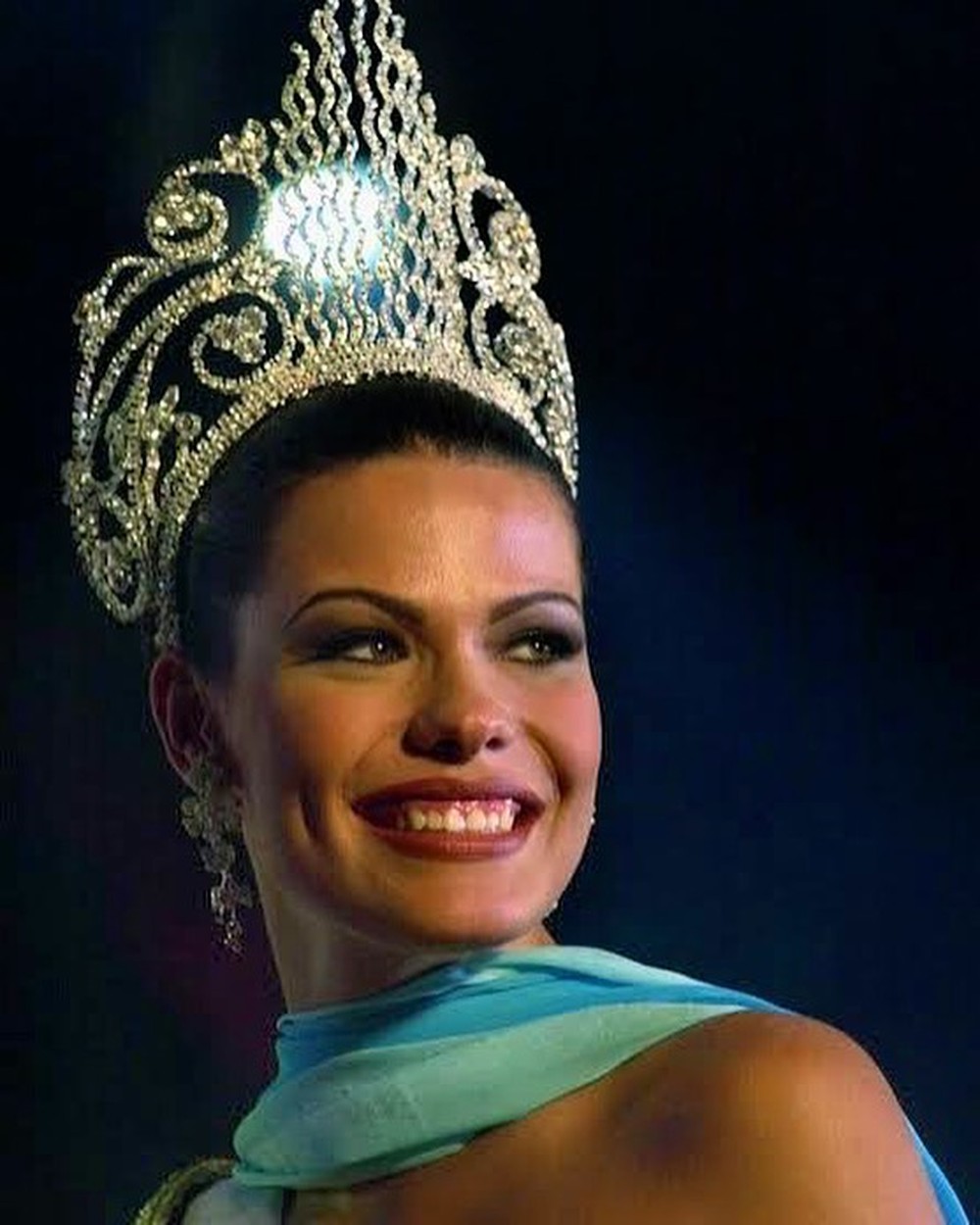 Ex-Miss e ex-BBB, Jose investe R$ 100 mil em procedimentos e recuperar ...