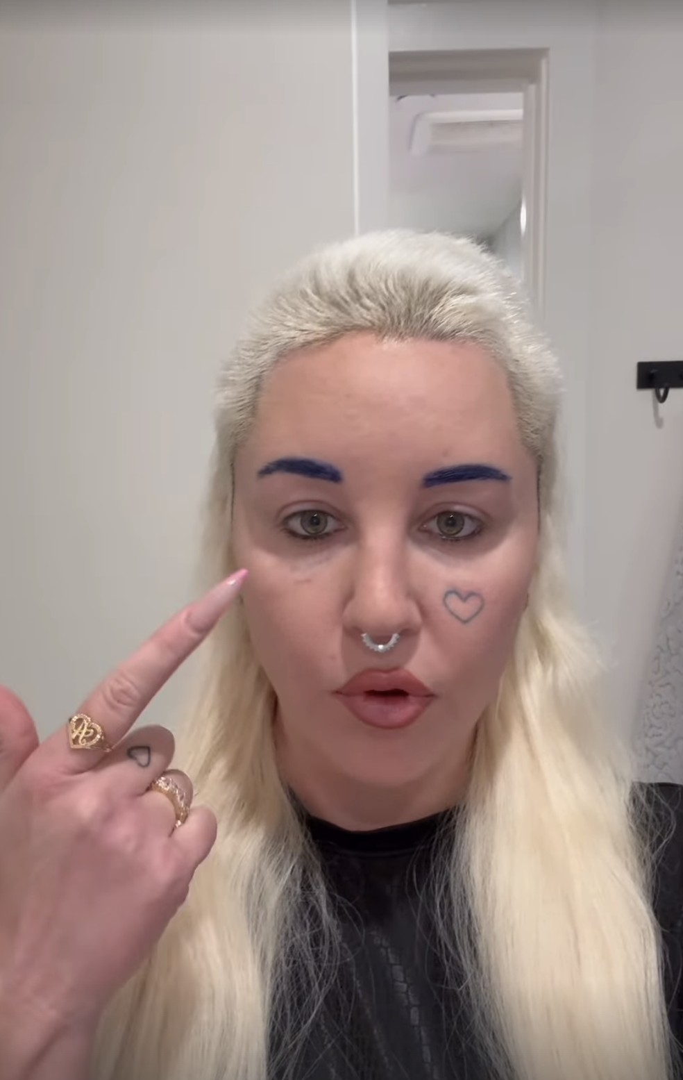 Amanda Bynes 2024 Antes E Depois