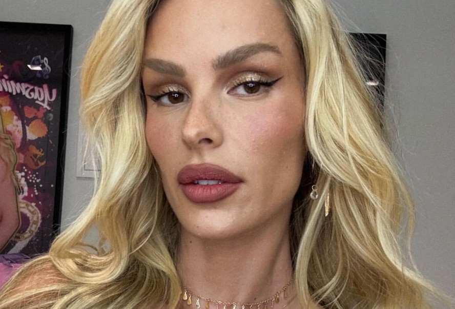 Yasmin Brunet mostra hematoma na perna e desabafa sobre lipedema: ‘Tá ...