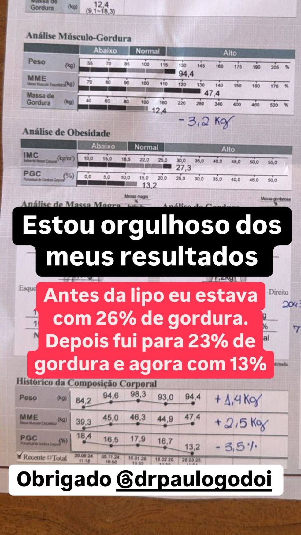 Eliezer impressiona com antes e depois após quatro meses de rotina ...
