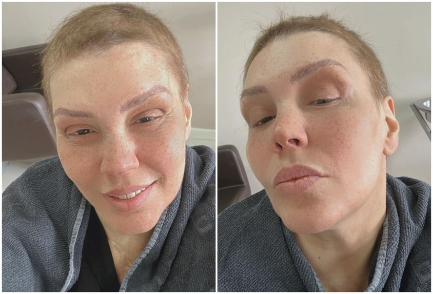 Com câncer em remissão, Simony mostra como está seu cabelo