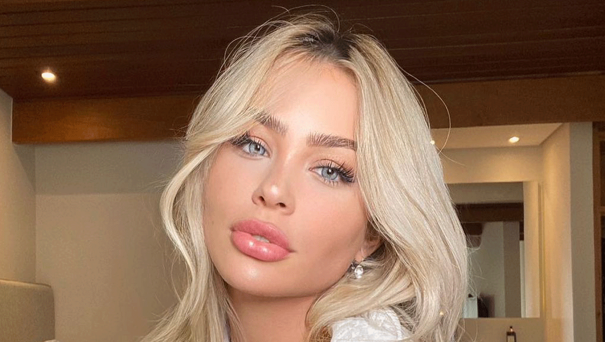 'Choque térmico aos 7 anos': Influencer Dainara Pariz conta como transformou a Paralisia de Bell ...