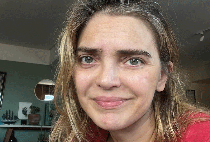 Câncer de pâncreas: entenda a doença que causou a morte da atriz Titina ...