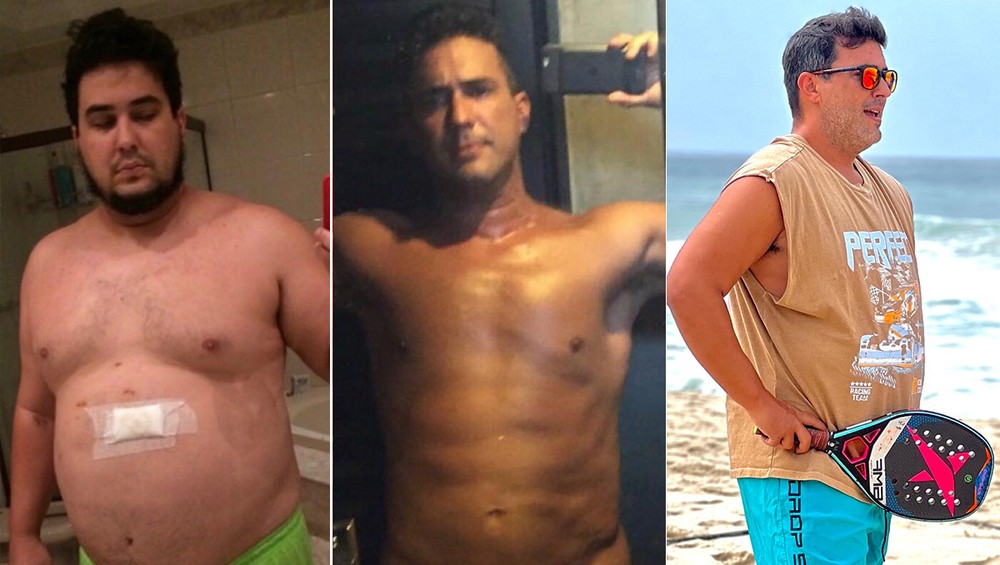 André Marques sobre desafio para manter peso após bariátrica: 'Me sinto um obeso em tratamento'