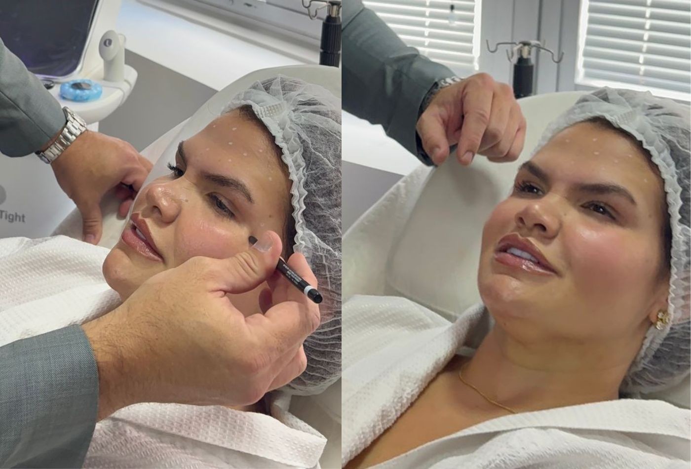Após perder mais de 80 kg, Thais Carla aplica botox e celebra: 'Se amar ...