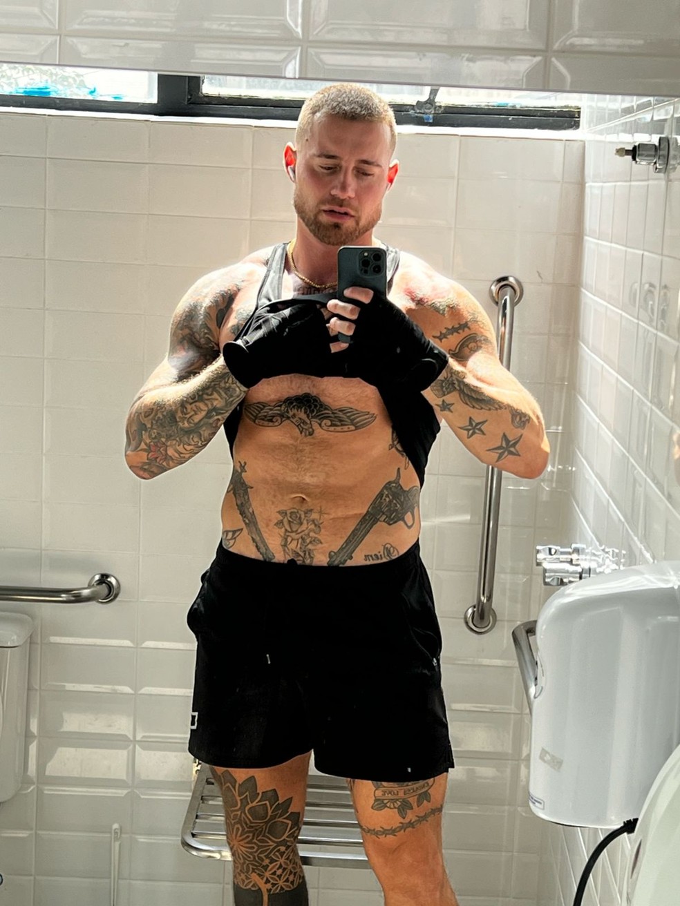 Bombeiro da Eliana diz ter gastado R$ 100 mil em procedimentos; antes e ...