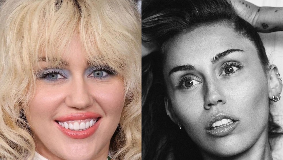 Miley Cyrus é detonada na web após procedimentos estéticos