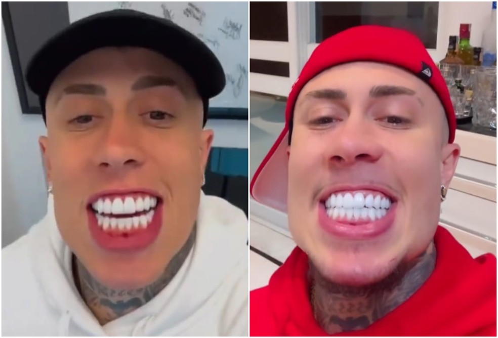 MC Daniel troca lentes de contato dos dentes e mostra resultado: 'Bem ...