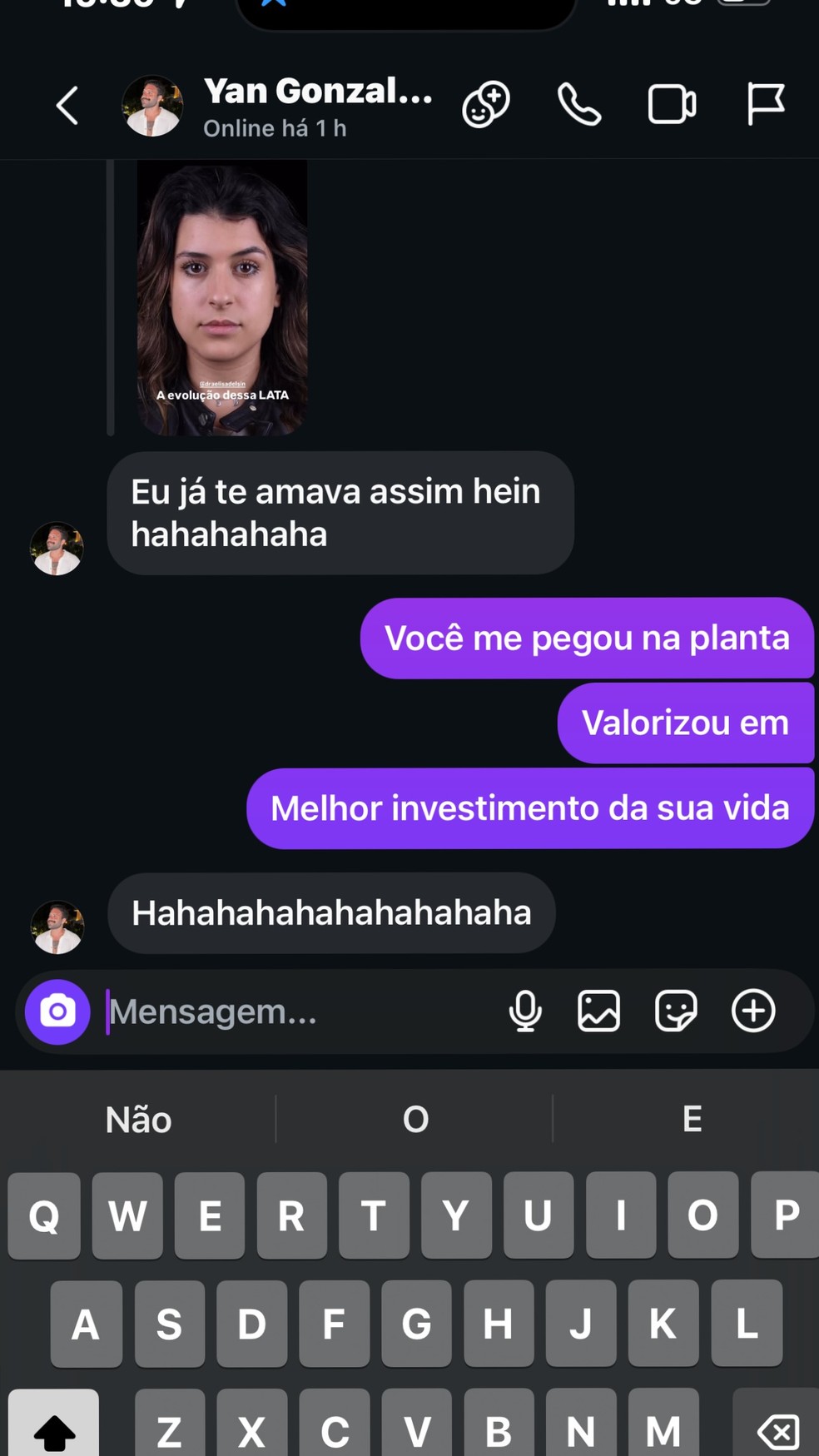 Luana Zucoloto atualiza harmonização facial pro casamento e compara com ...