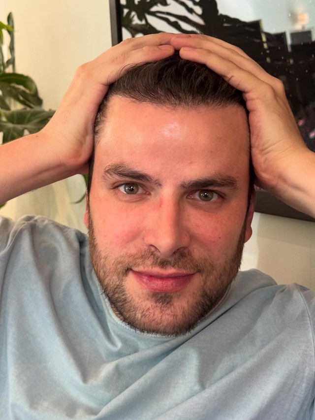 Após harmonização, transplante e emagrecimento, ex-BBB Gustavo avisa ...